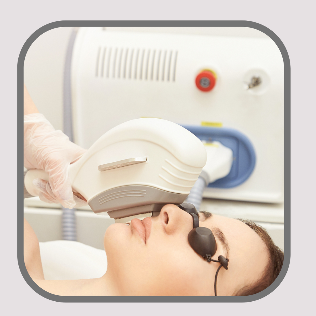 Skin Rejuvenation – The Laser Station