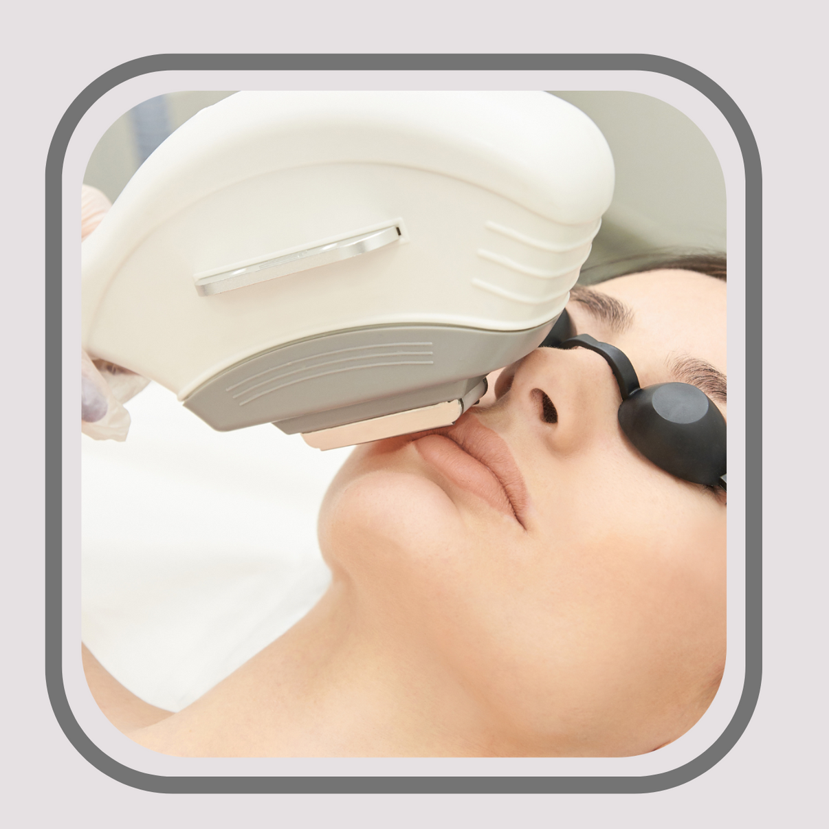 Wrinkle Therapy – The Laser Station